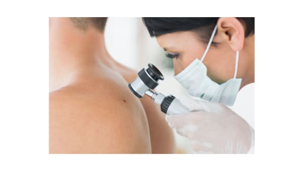 Reduction in immunotherapy treatment for skin cancer shows promise in ...